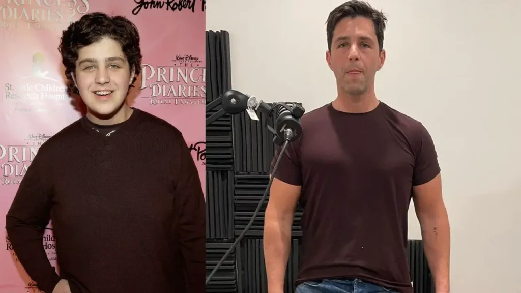 Josh Peck's Plastic Surgery: Before and After Pictures! - Celebs In-depth