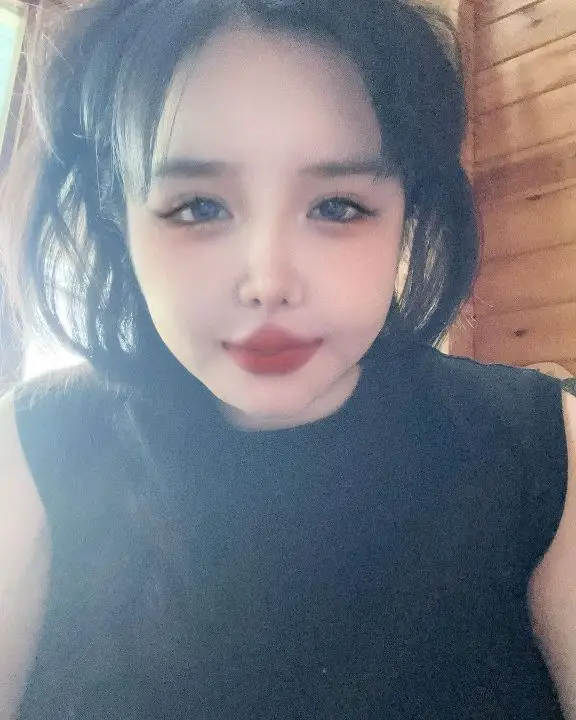 Park Bom's Plastic Surgery: Before and After, Instagram's Younger ...