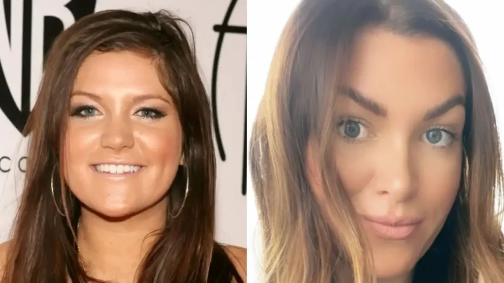 Alex M’s Plastic Surgery: Laguna Beach Star’s Transformation Is the ...