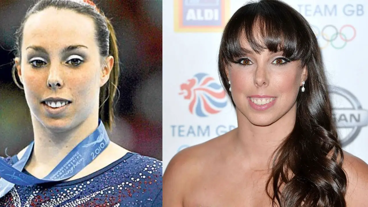 Beth Tweddle’s Plastic Surgery: Are the Rumors True? - Celebs In-depth