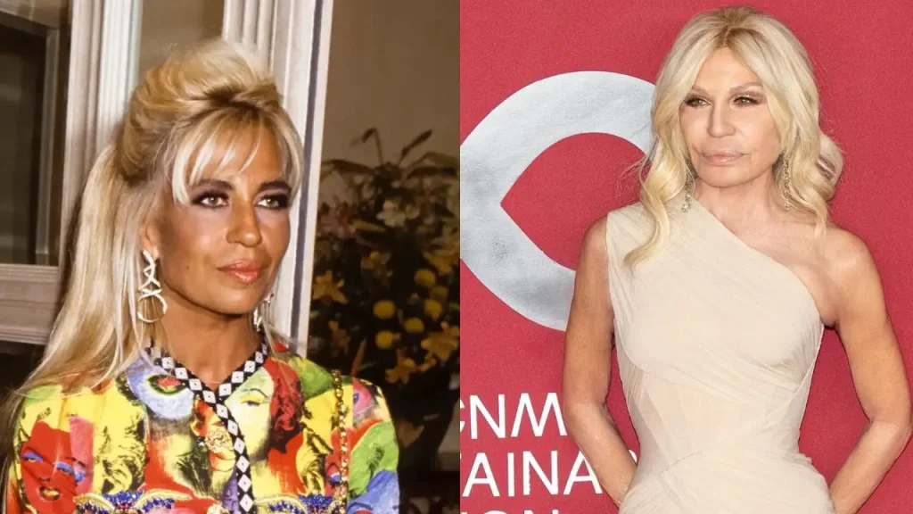 Donatella Versace Plastic Surgery: She Looks Horrible in 2023! - Celebs ...