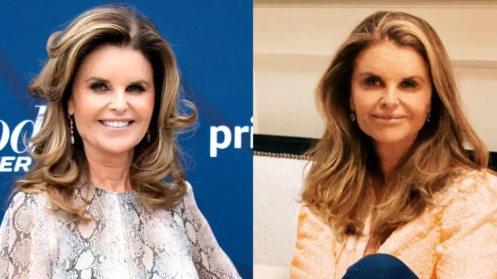 Maria Shriver’s Plastic Surgery: No Longer Recognizable While Spotted ...